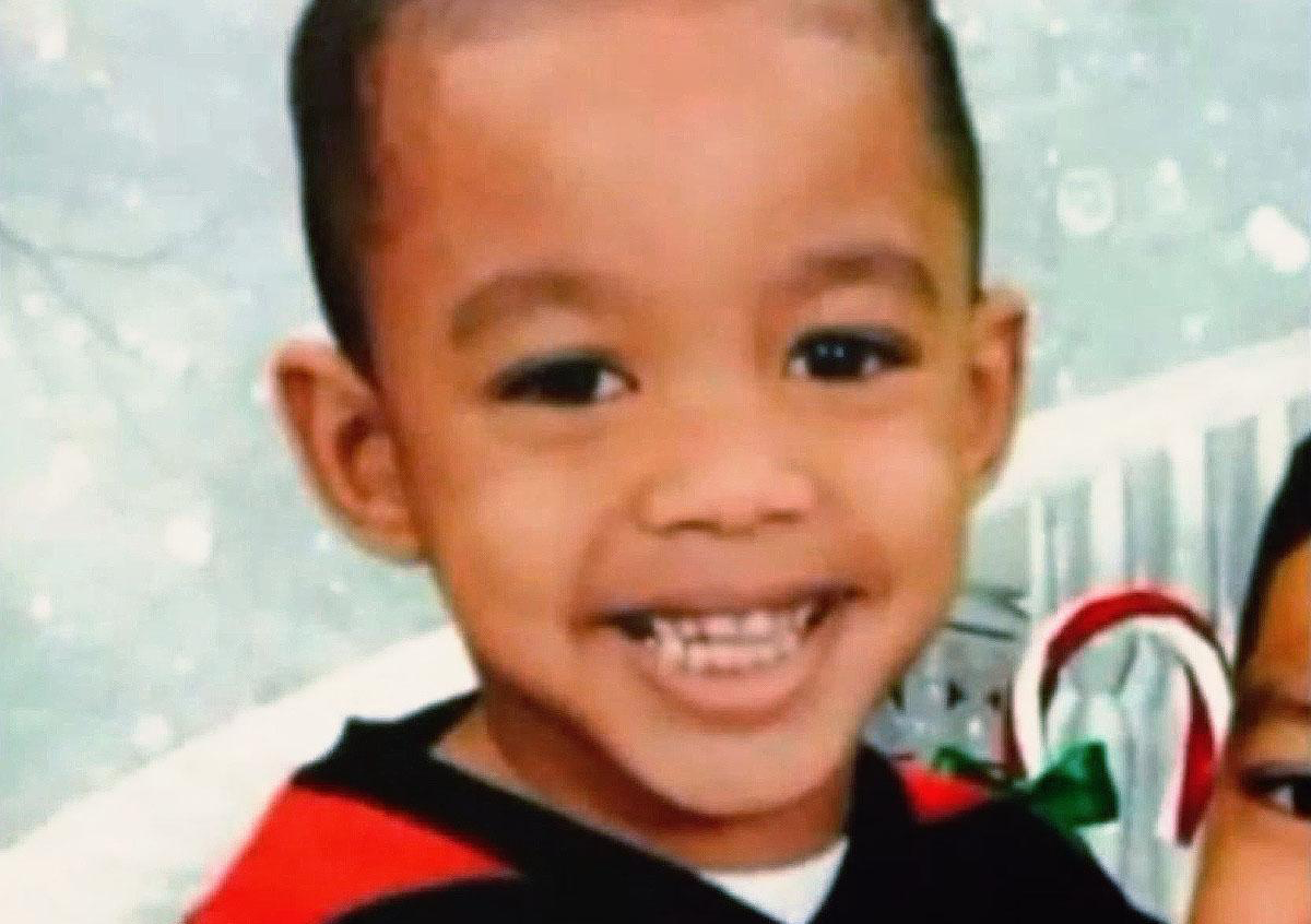 Video: Pit bull en su residencia le destrozó el rostro a este niño - El ...