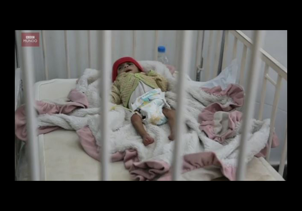 Video: La brutal realidad de los niños desnutridos que no tienen fuerza ...