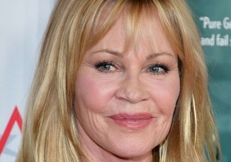 Fotos: El cambio de cara de Melanie Griffith que sorprendió a sus ...