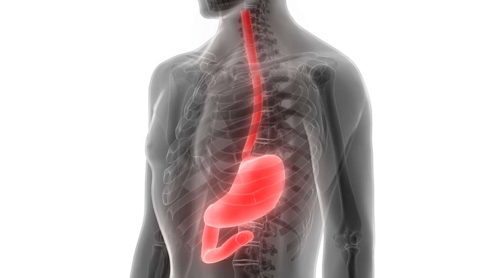 ¿Qué significa tener várices en el esófago? - El Diario NY