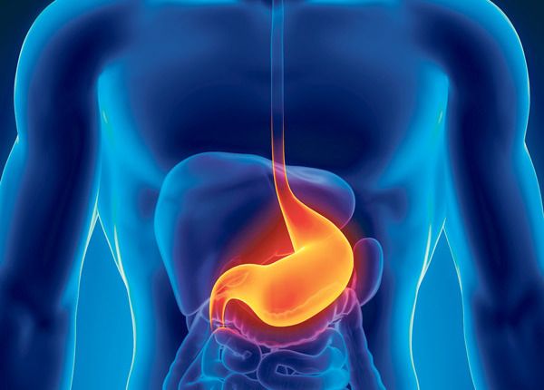 Cirugía del esófago: Una buena alternativa para combatir el reflujo ...