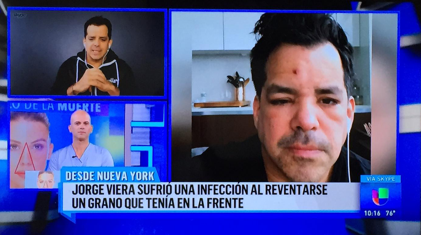 Jorge Viera sufrió una infección que le desfiguró la cara y lo mandó al ...