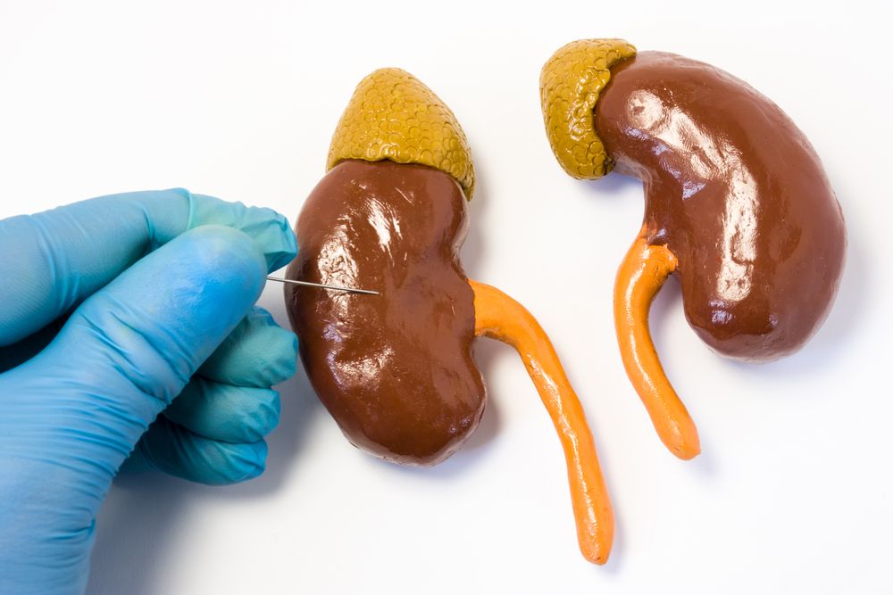 ¿Para qué se realiza una biopsia renal y cuál es su importancia? | El ...