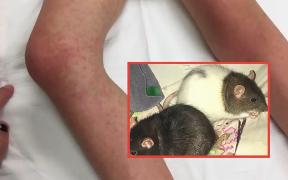 Niña contrae grave enfermedad por contacto con ratas domésticas - El ...