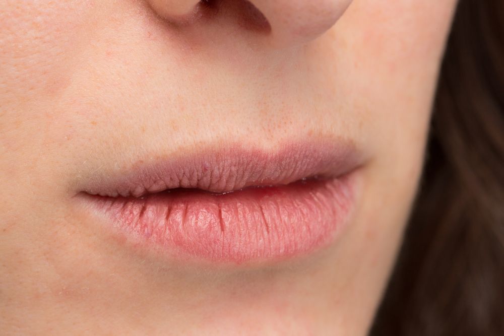 4 productos para aliviar los labios partidos y restaurarlos en pocas ...