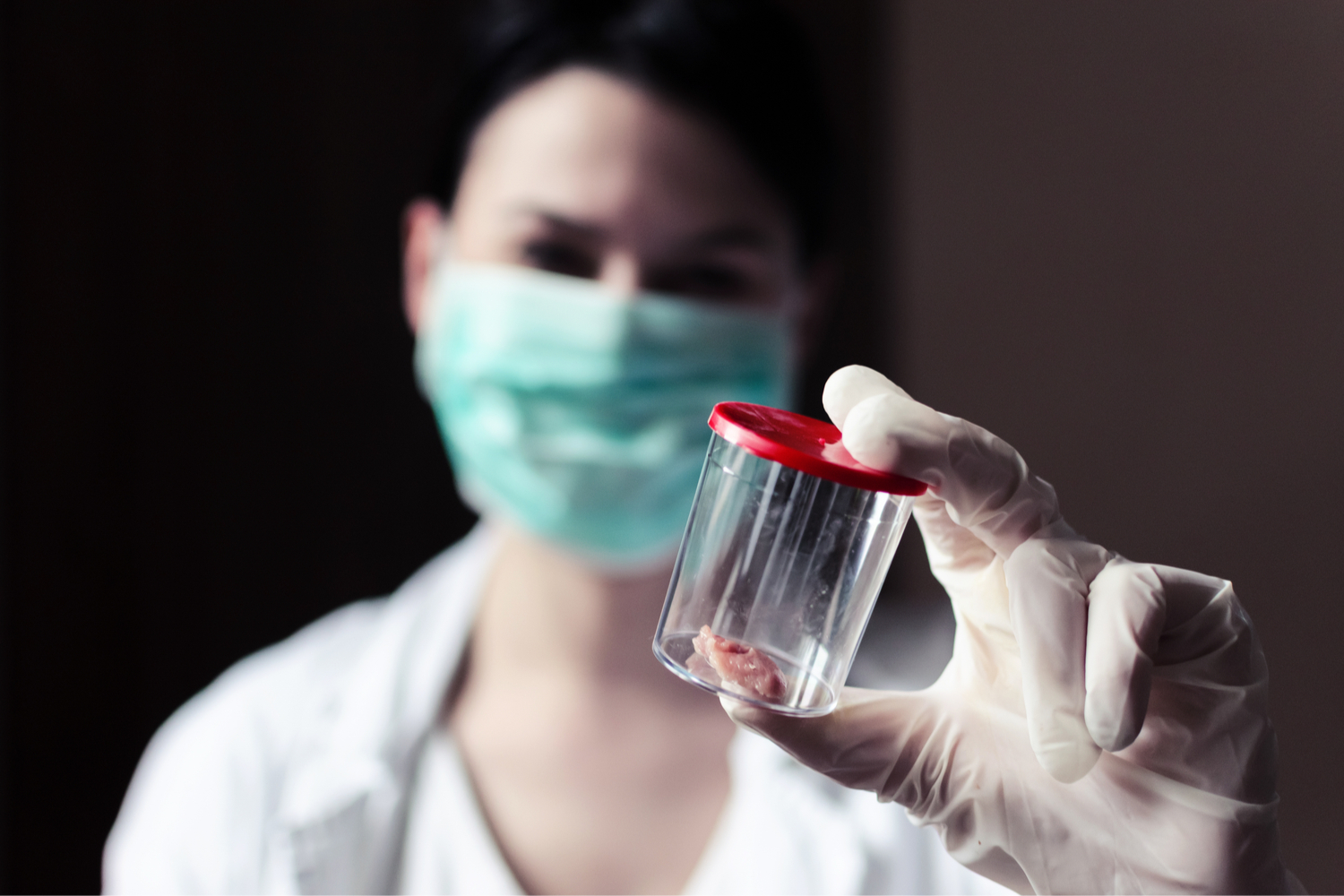 Cómo es una intervención para hacer una biopsia de senos - El Diario NY