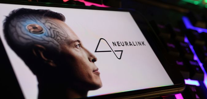 Implante Cerebral De Neuralink Falla Detectan Problemas En El Hombre
