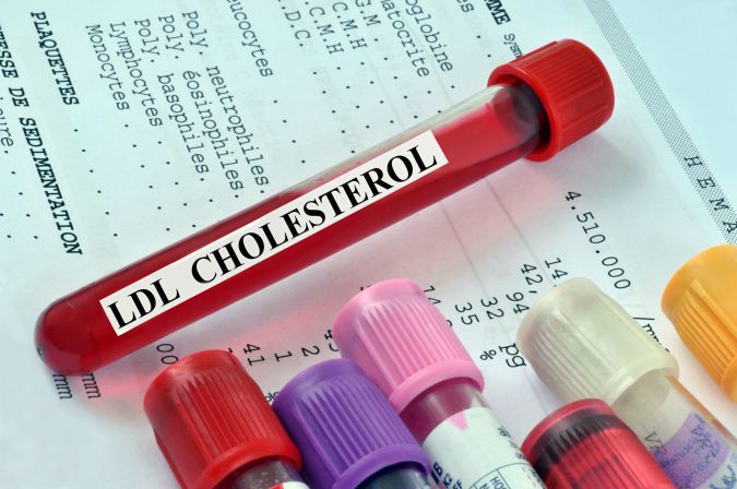 Control del colesterol: medidas preventivas para la salud cardíaca - El ...