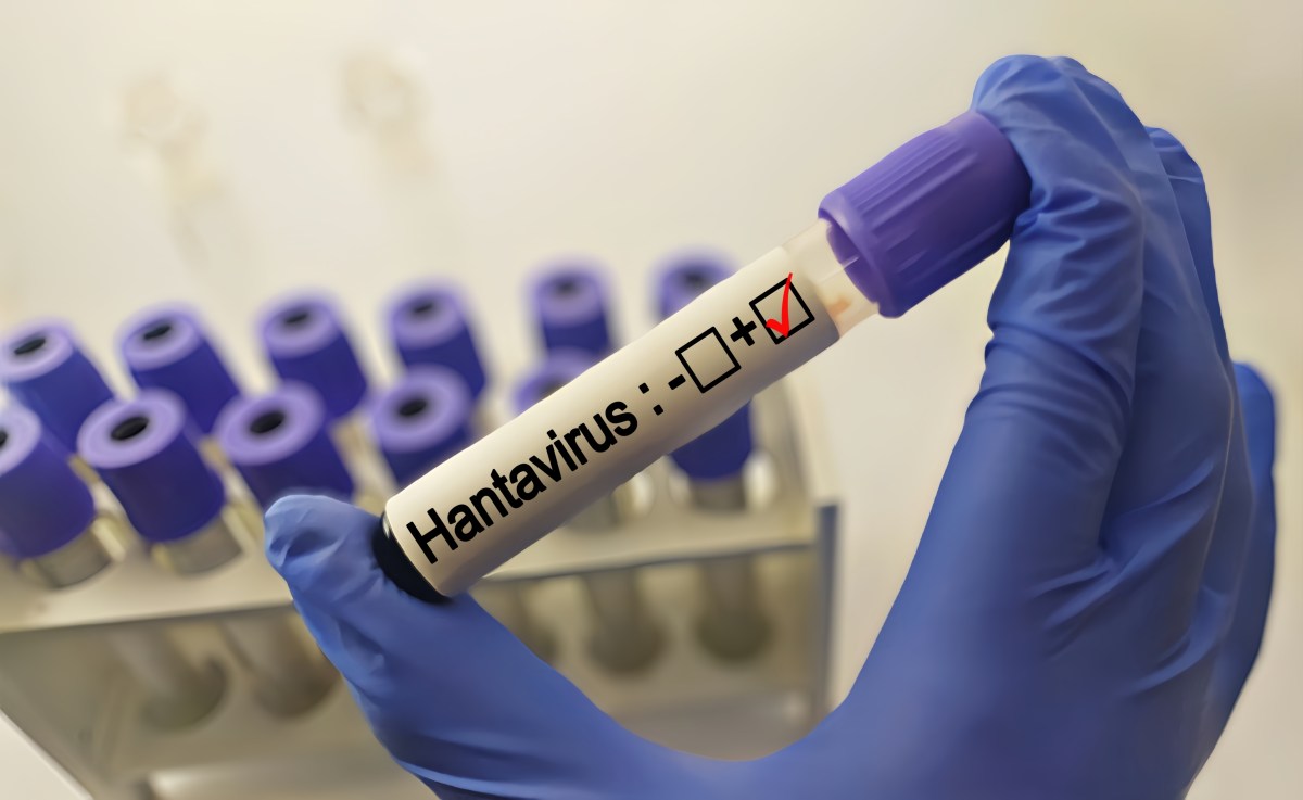 ¿Puedo morir por Hantavirus? Expertos lo aclaran - El Diario NY